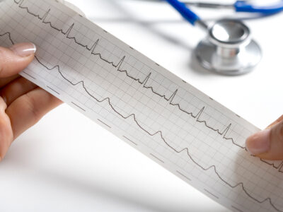 ECG Interpretation Course
