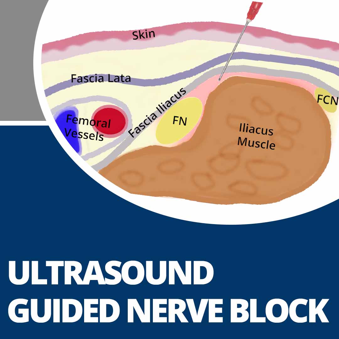 Courses Archive - FRCEM, MRCEM, Ultrasound Emergency Medicine Courses